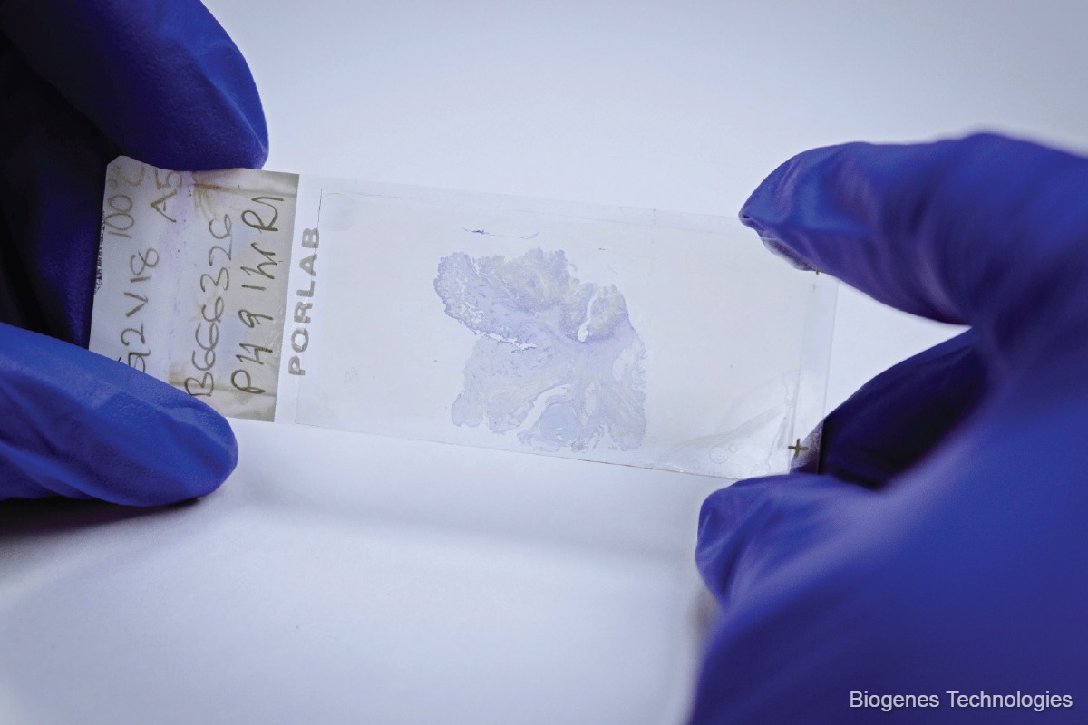Start-up: Biogenes develops method for easier screening of HPV