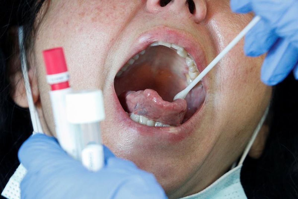 Another Covid-19 self-test kit receives conditional approval | KLSE ...